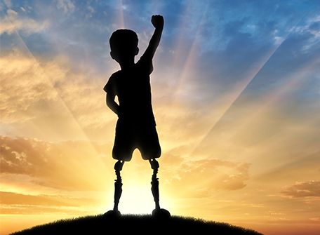 Top 5 Advantages of Using Prosthetics for Children