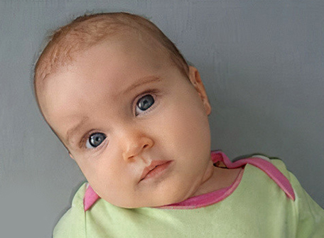 Torticollis in Babies | Spot & Treat Early