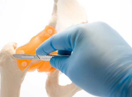 Bone Tumor in Leg Dubai | Hope AMC Center