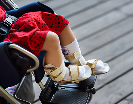 A Detailed Overview of Pediatric Prosthetics & Orthotics Care